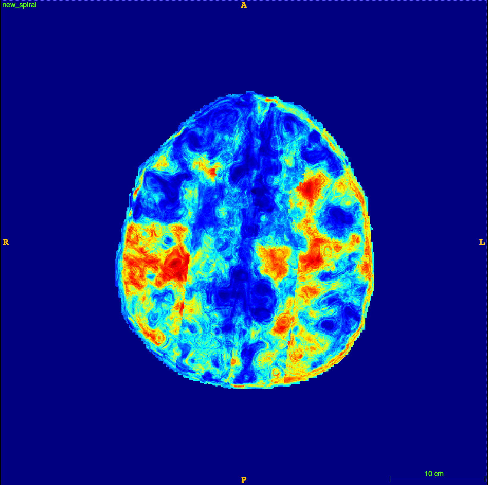 Andromeda Medical Imaging