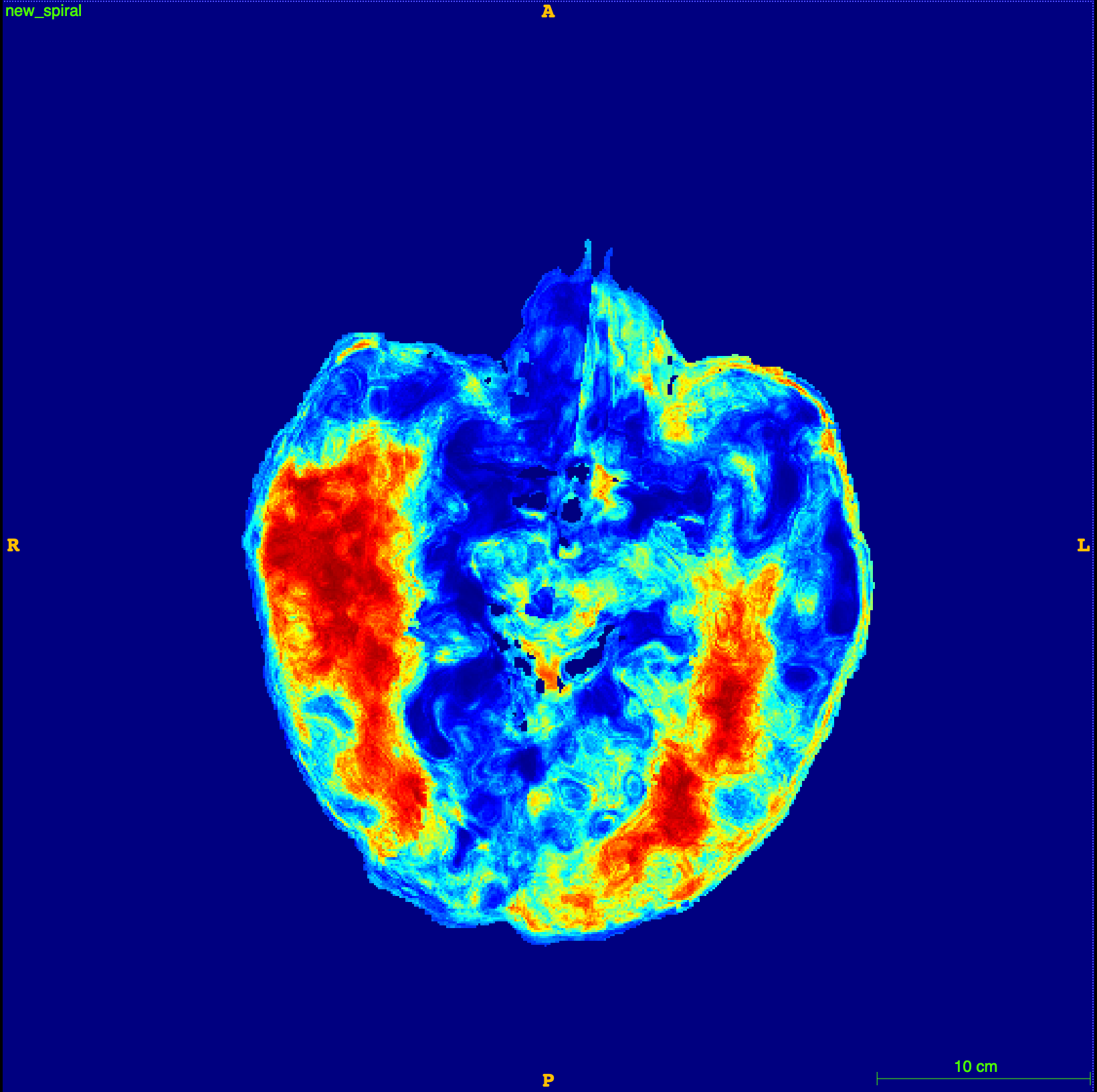 Andromeda Medical Imaging
