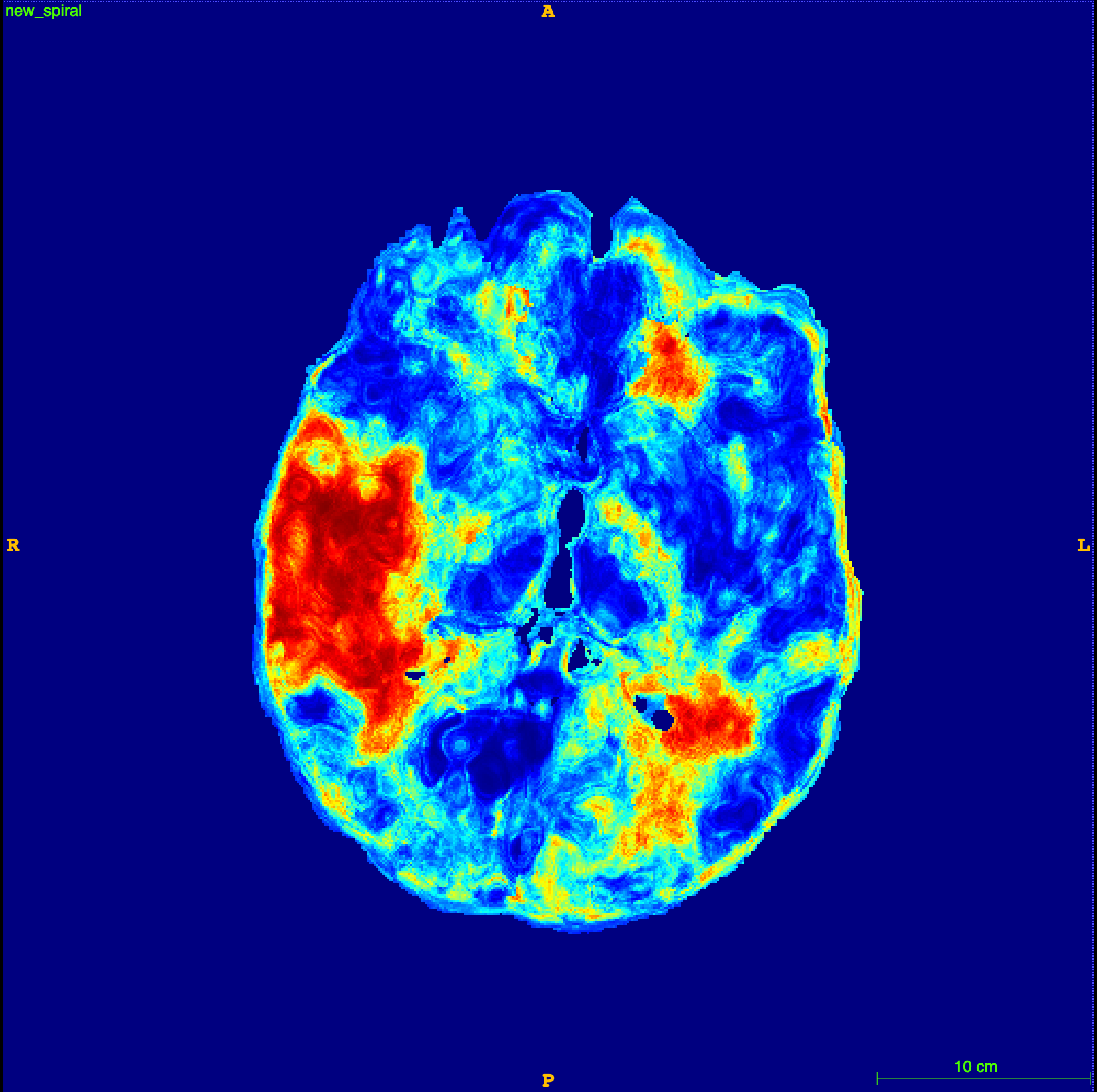 Andromeda Medical Imaging