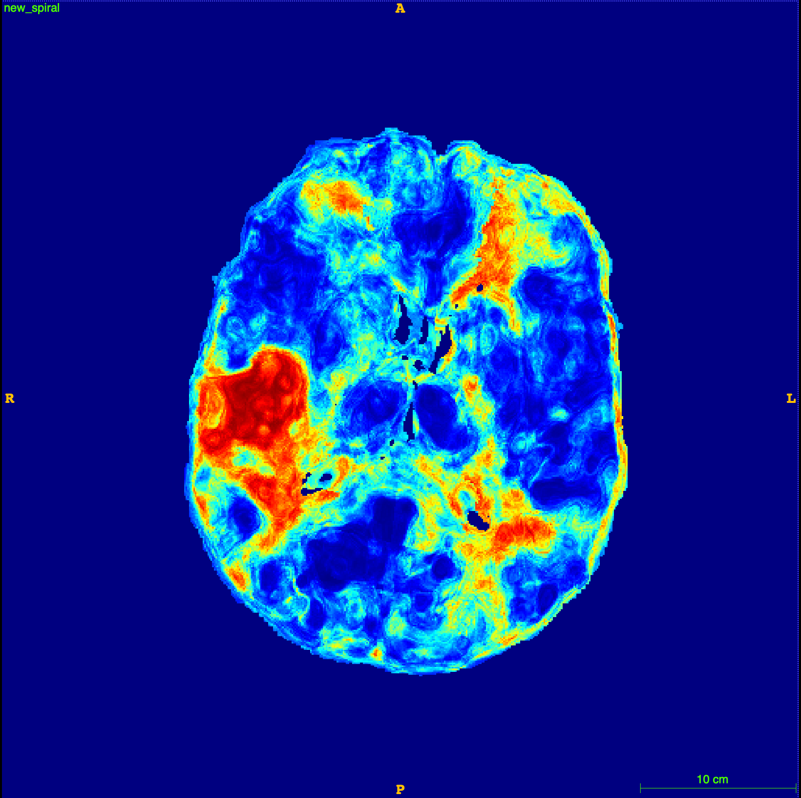 Andromeda Medical Imaging
